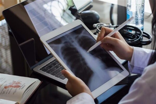 Understanding Digital X-rays: A Modern Approach to Medical Imaging ...